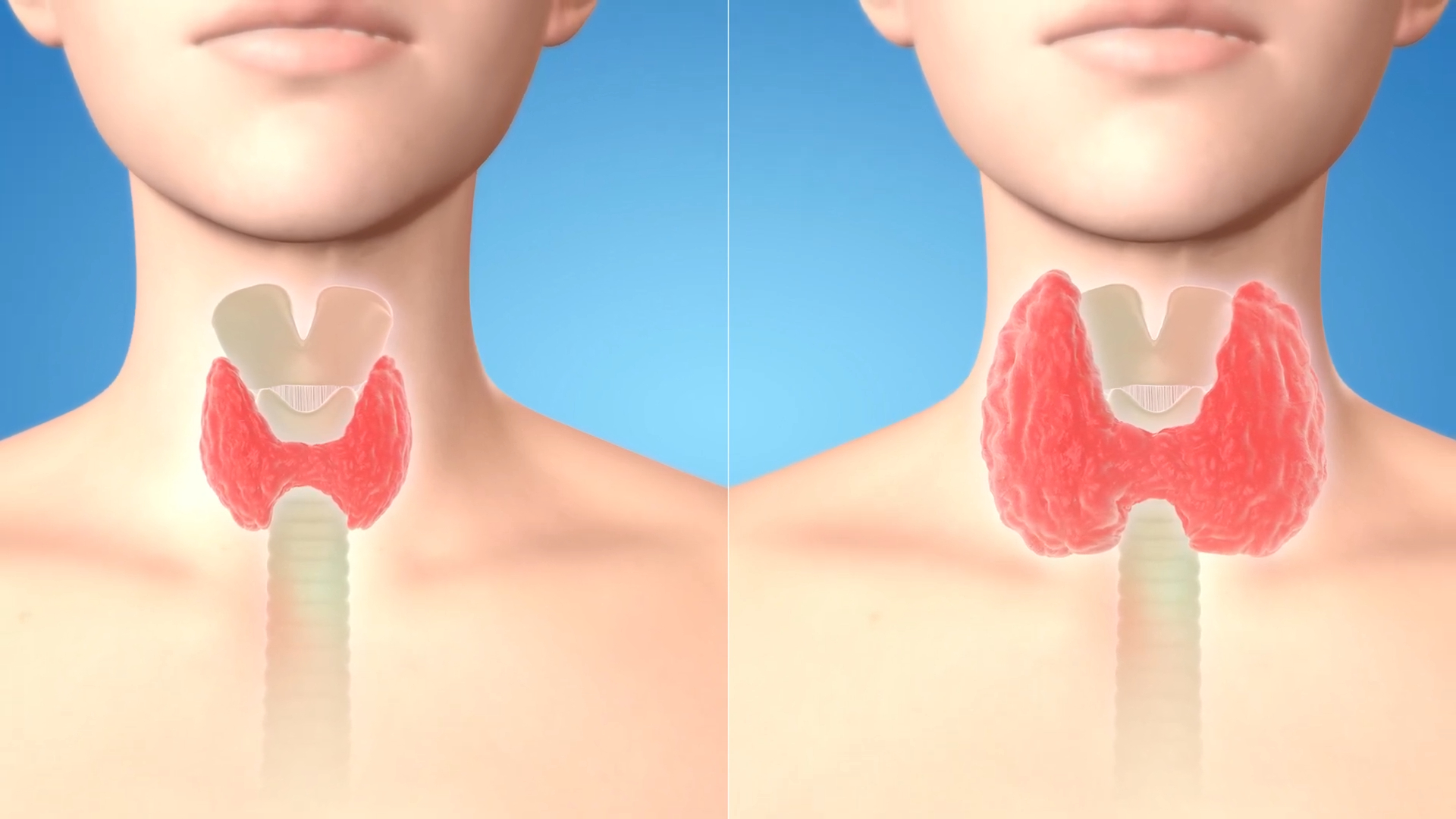 Ishrana i štitna žlezda - Koje namirnice pomažu a koje odmažu?